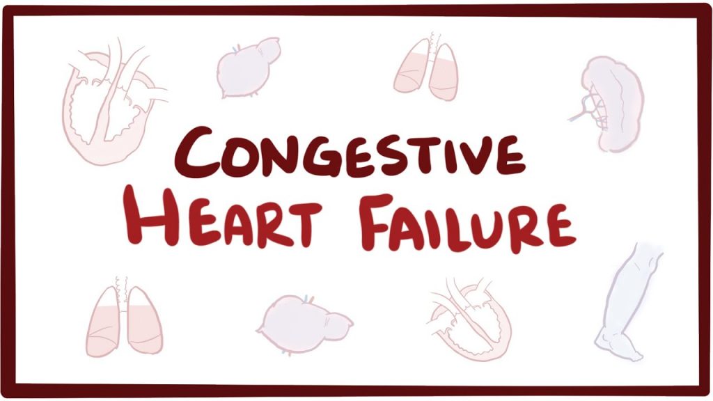 Congestive heart failure (CHF) – systolic, diastolic, left side, right ...